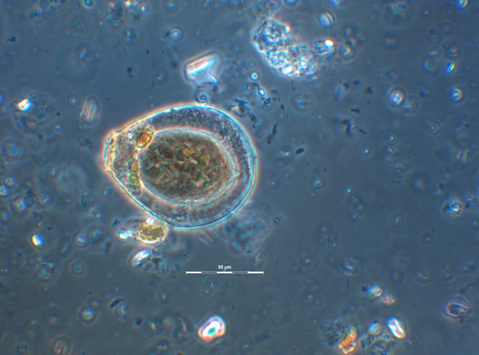 Testate amoebae – a beginner’s guide to a fascinating microworld ...